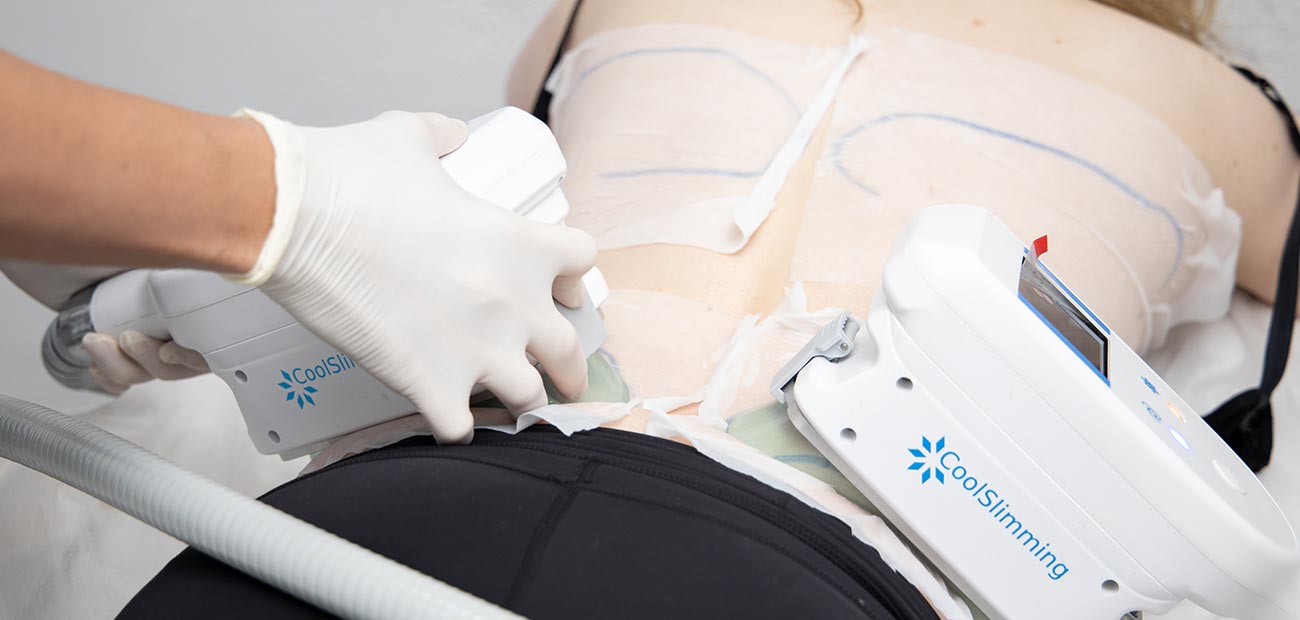 Advantages of Fat Freezing Over Traditional Liposuction - Clicko Health